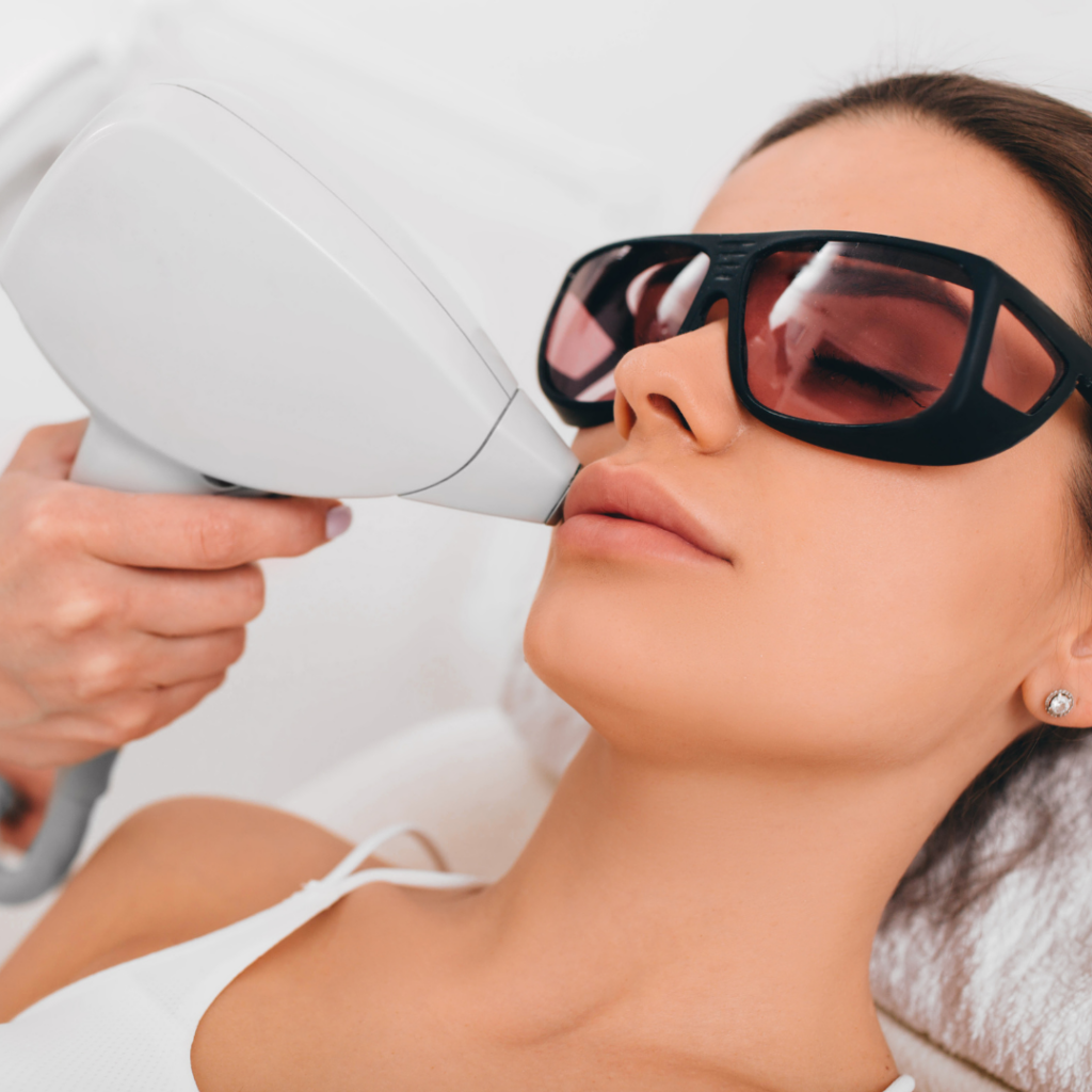 Laser Lip - Elevation Med Spa